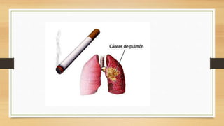 CÁNCER DE PULMÓN | PPTX