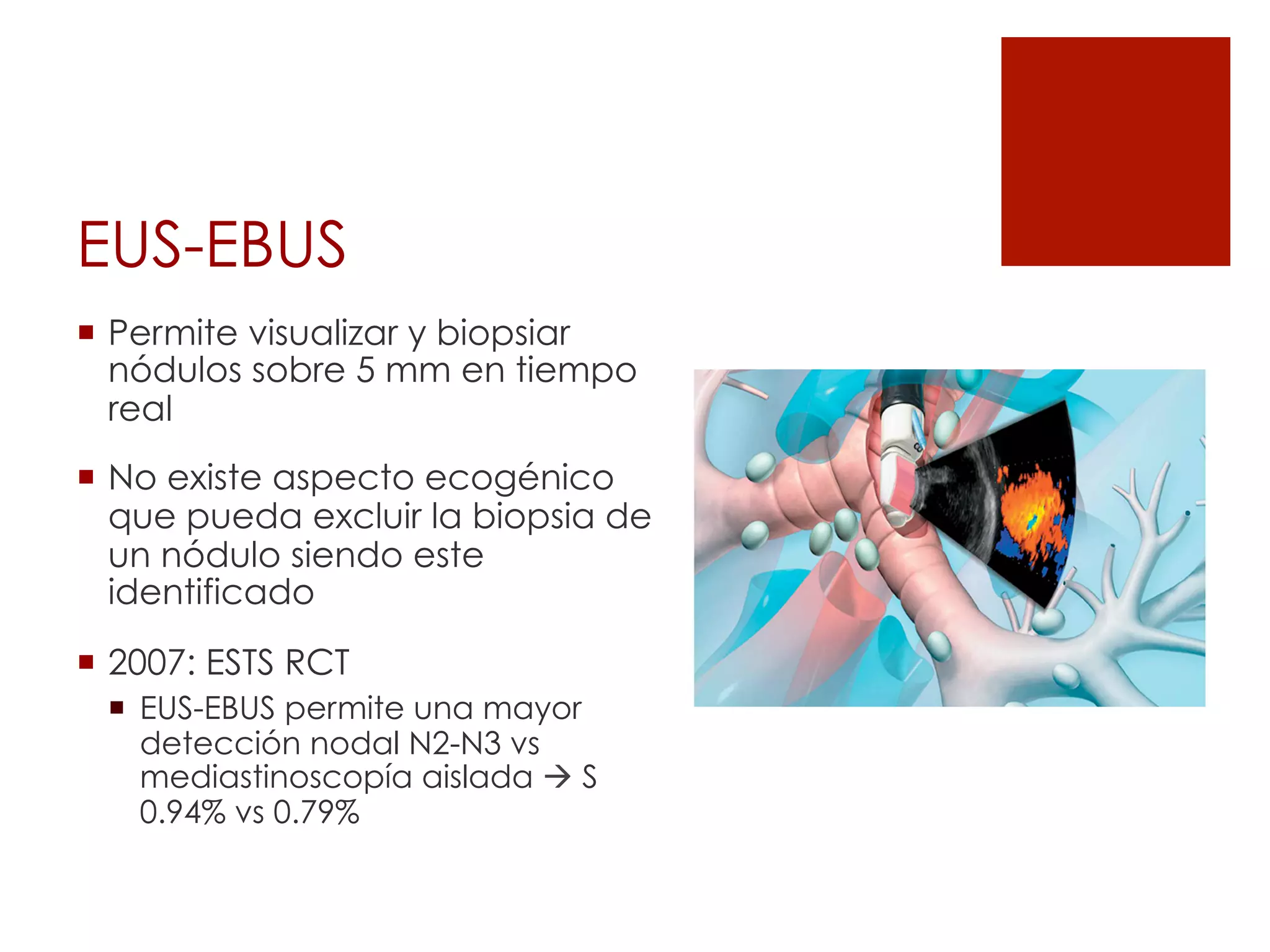 Cancer de pulmon uv | PDF