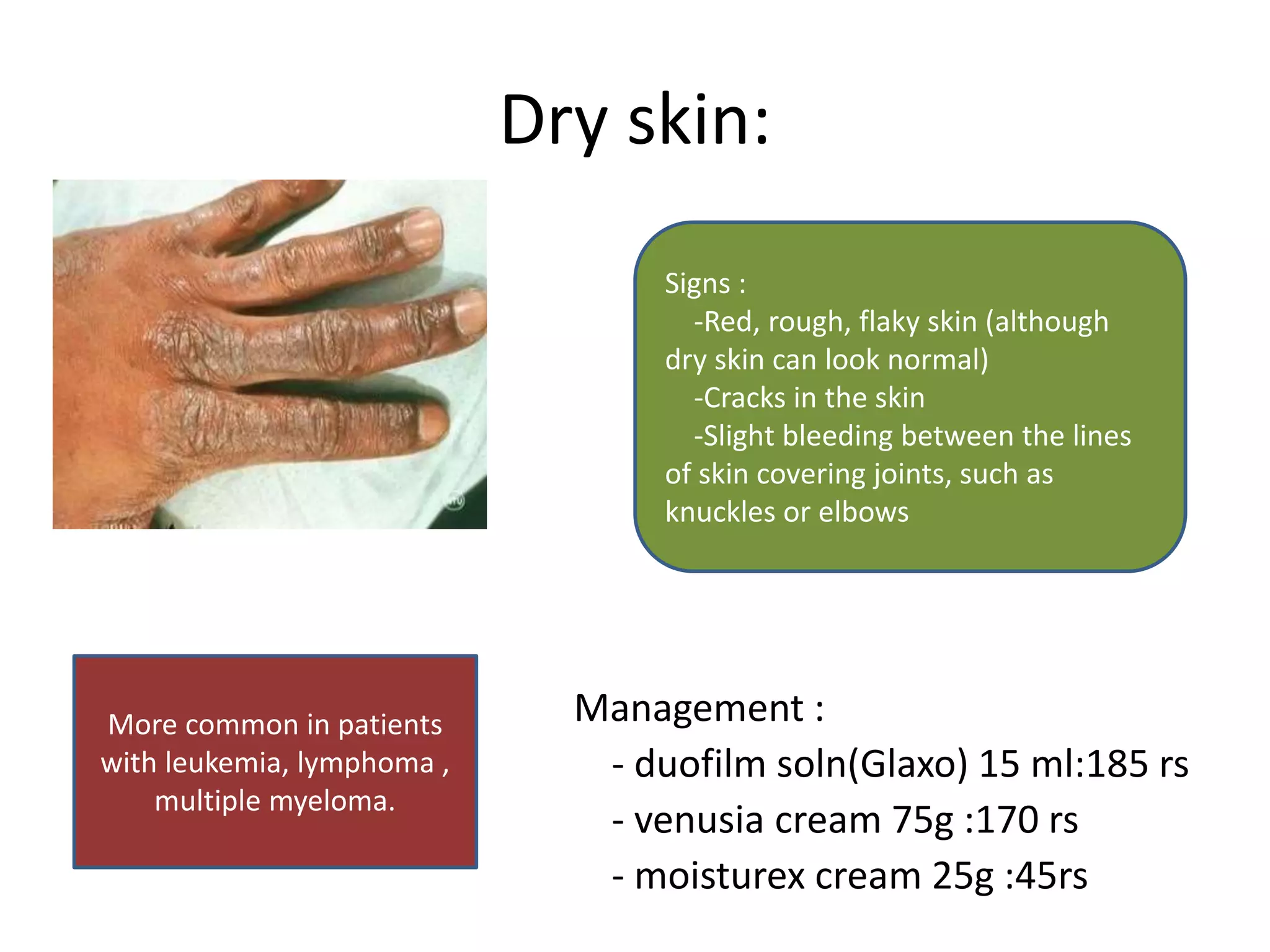Cancer derma | PPT