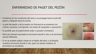 Cancer de seno | PPTX
