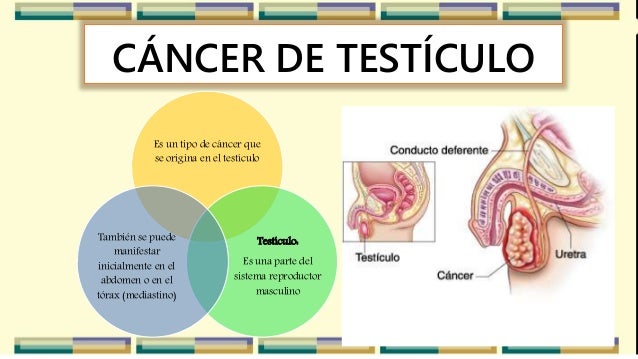 Cancer De Testiculo