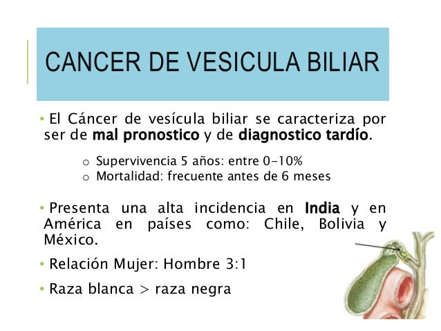 Cancer De Vesicula Biliar