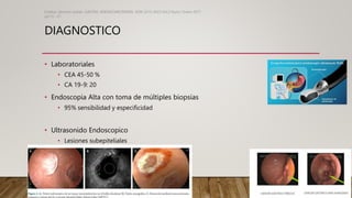 cancer gastrico MEDICINA INTERNA PRESENTACION | PPTX