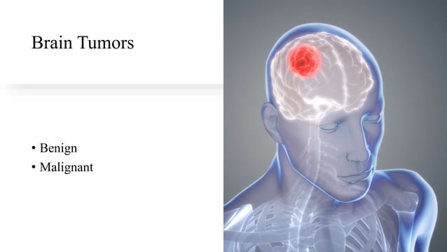 Cancer immunotherapy for brain tumors (1).pptx