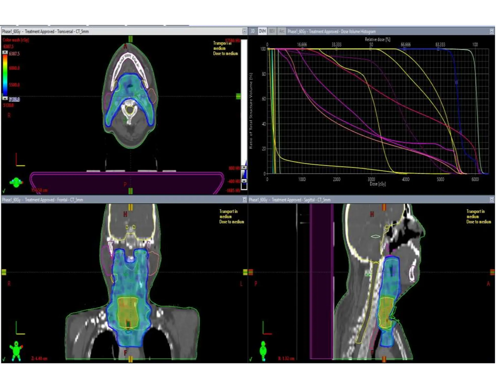 RADIATION TECHNIQUES AND MACHINES, CHANGING ERA WITH HALCYON | PPTX
