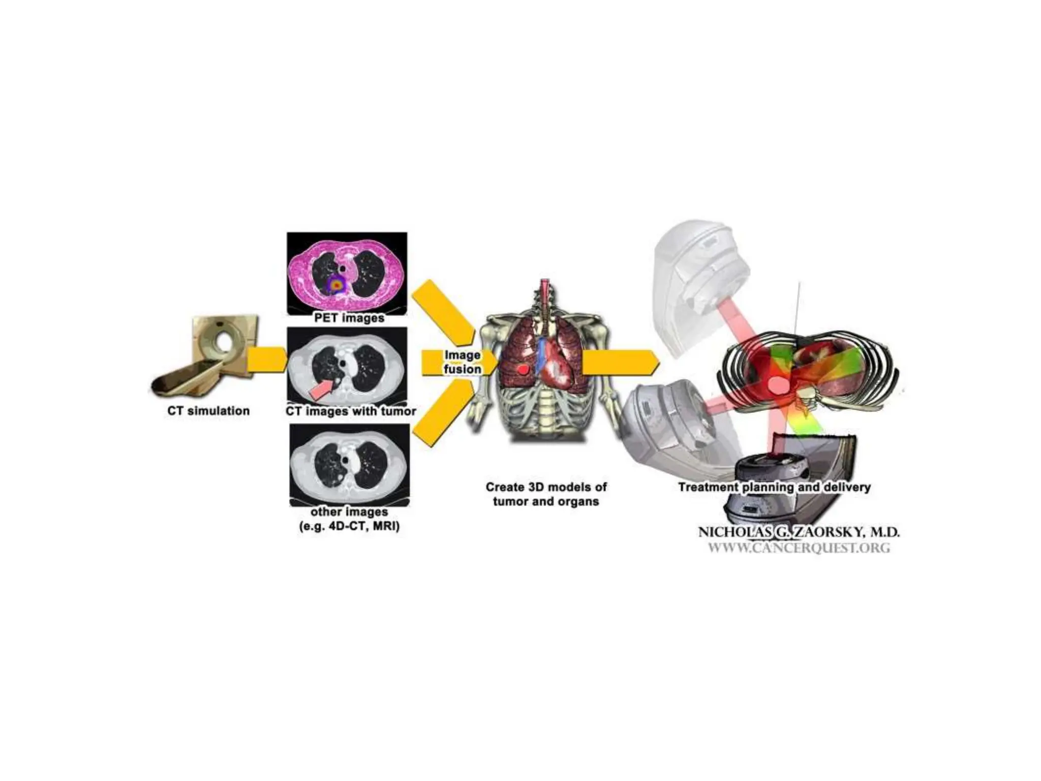 RADIATION TECHNIQUES AND MACHINES, CHANGING ERA WITH HALCYON | PPTX