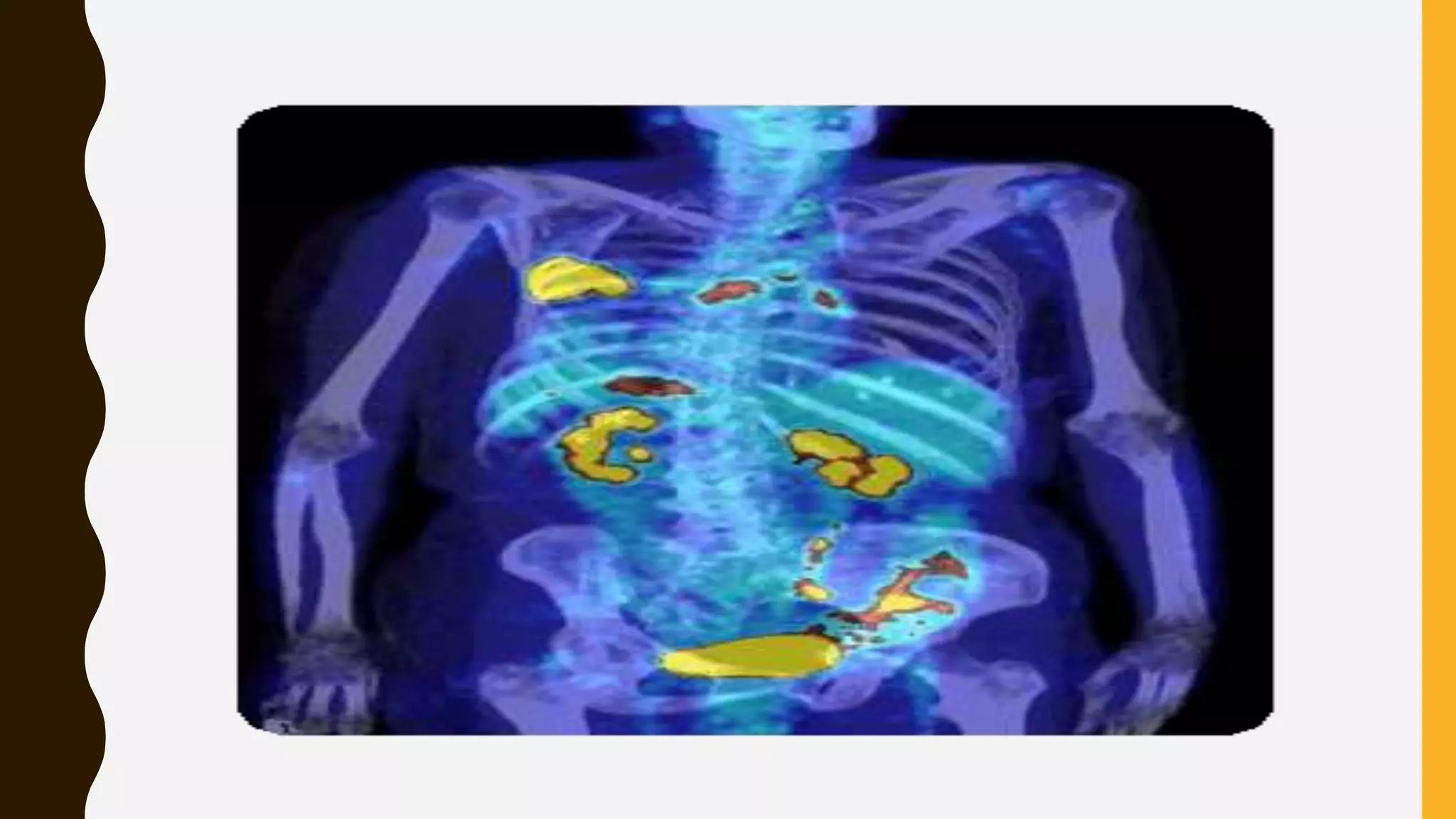 Cancer introduction | PPTX