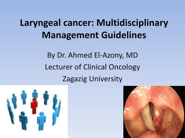 Management of Cancer larynx | PPT