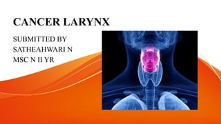 CANCER OF LARYNX AND ITS DETAILED MANAGEMENT | PPTX