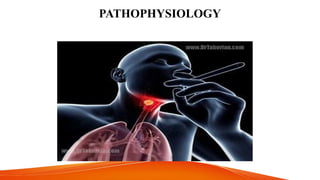 CANCER OF LARYNX AND ITS DETAILED MANAGEMENT | PPTX