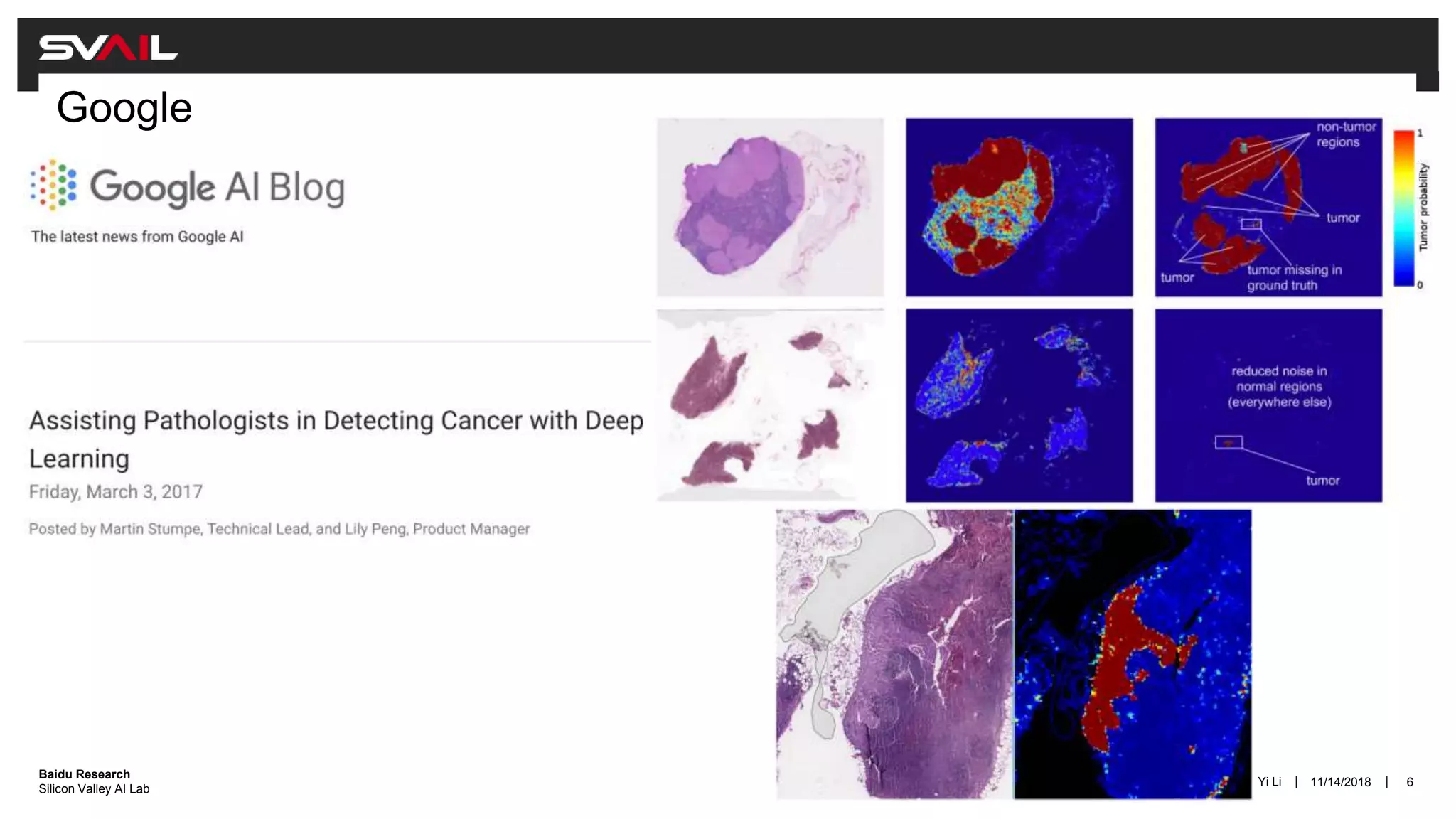 Cancer Metastasis Detection With Neural Conditional Random Field Ppt