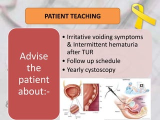 Cancer of bladder | PPTX