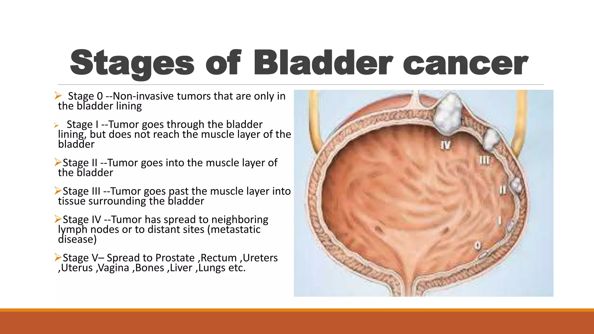 Cancer of bladder | PPTX