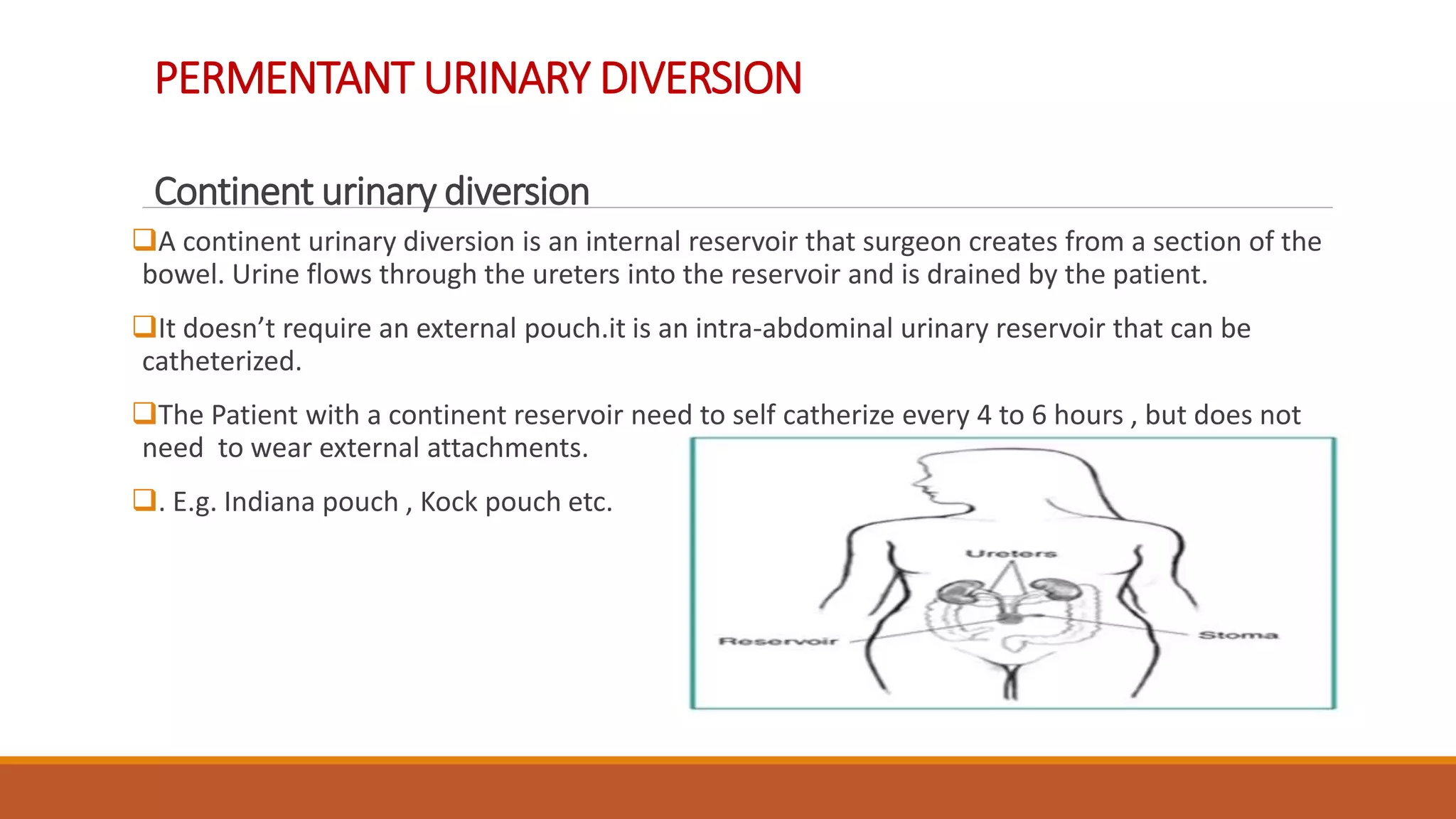 Cancer of bladder | PPTX