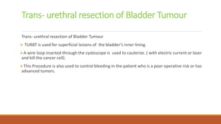 Cancer of bladder | PPTX