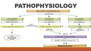 Cancer of bladder | PPTX