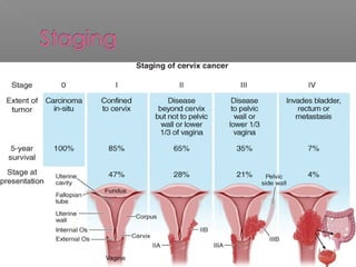 Cancer of cervix | PPT | Cancer | Diseases and Conditions