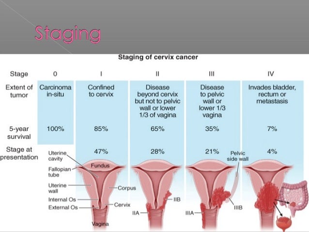 Cancer of cervix