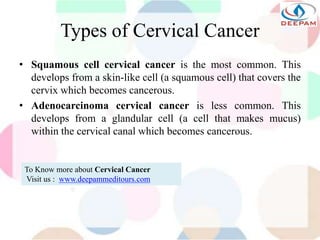 Cancer of Cervix | PPTX