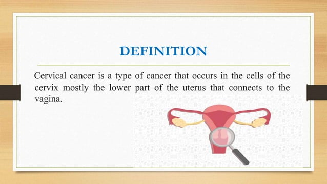 Cancer of cervix and its management | PPTX