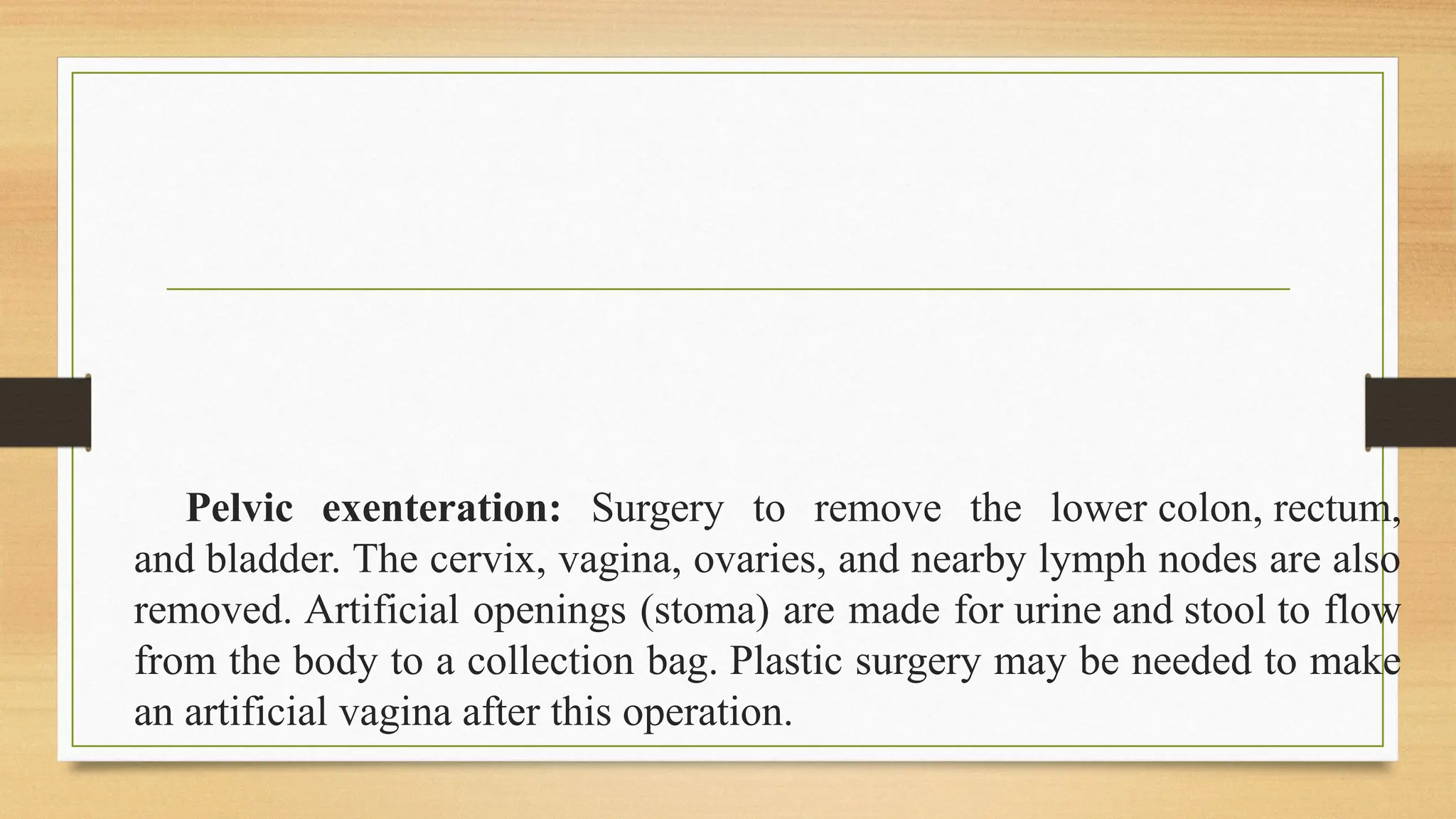 cancer of cervix and its management 2.pptx