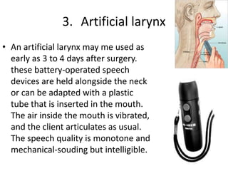 Cancer of larynx | PPTX