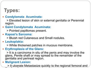 Cancer of penis | PPTX