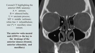 Cancer of the Nasal Cavity and paranasal sinus .pptx