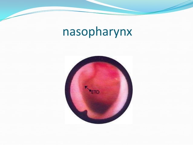 Cancer of the nasopharynx | PPT