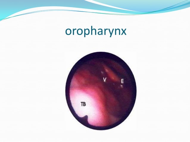Cancer of the nasopharynx | PPT
