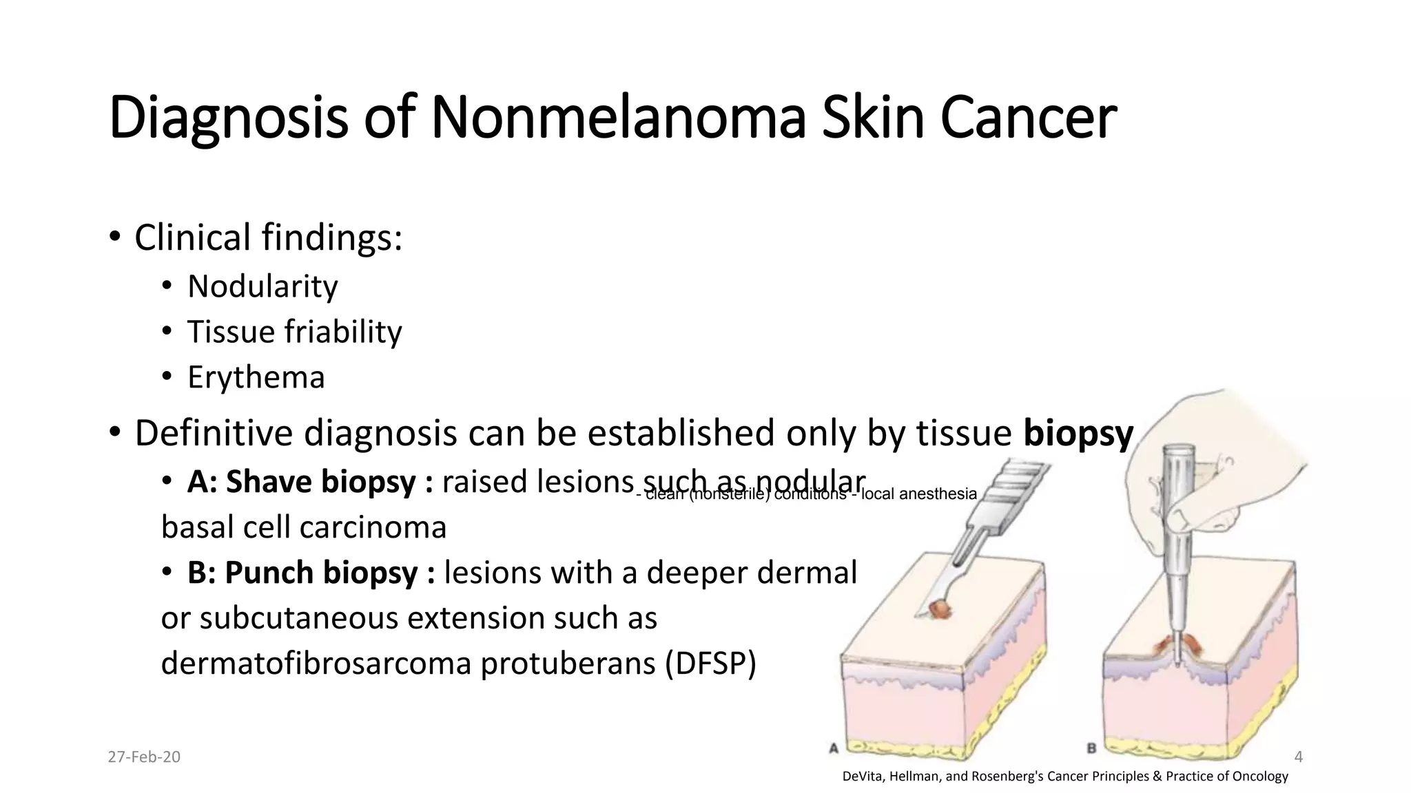 Cancer of the skin | PPTX