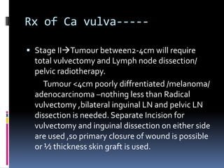 Cancer of vulva | PPTX