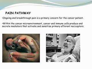 Cancer pain management | PPTX