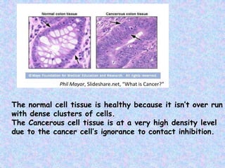 Cancer power point | PPTX | Cancer | Diseases and Conditions