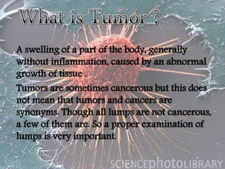 Cancer | PPT