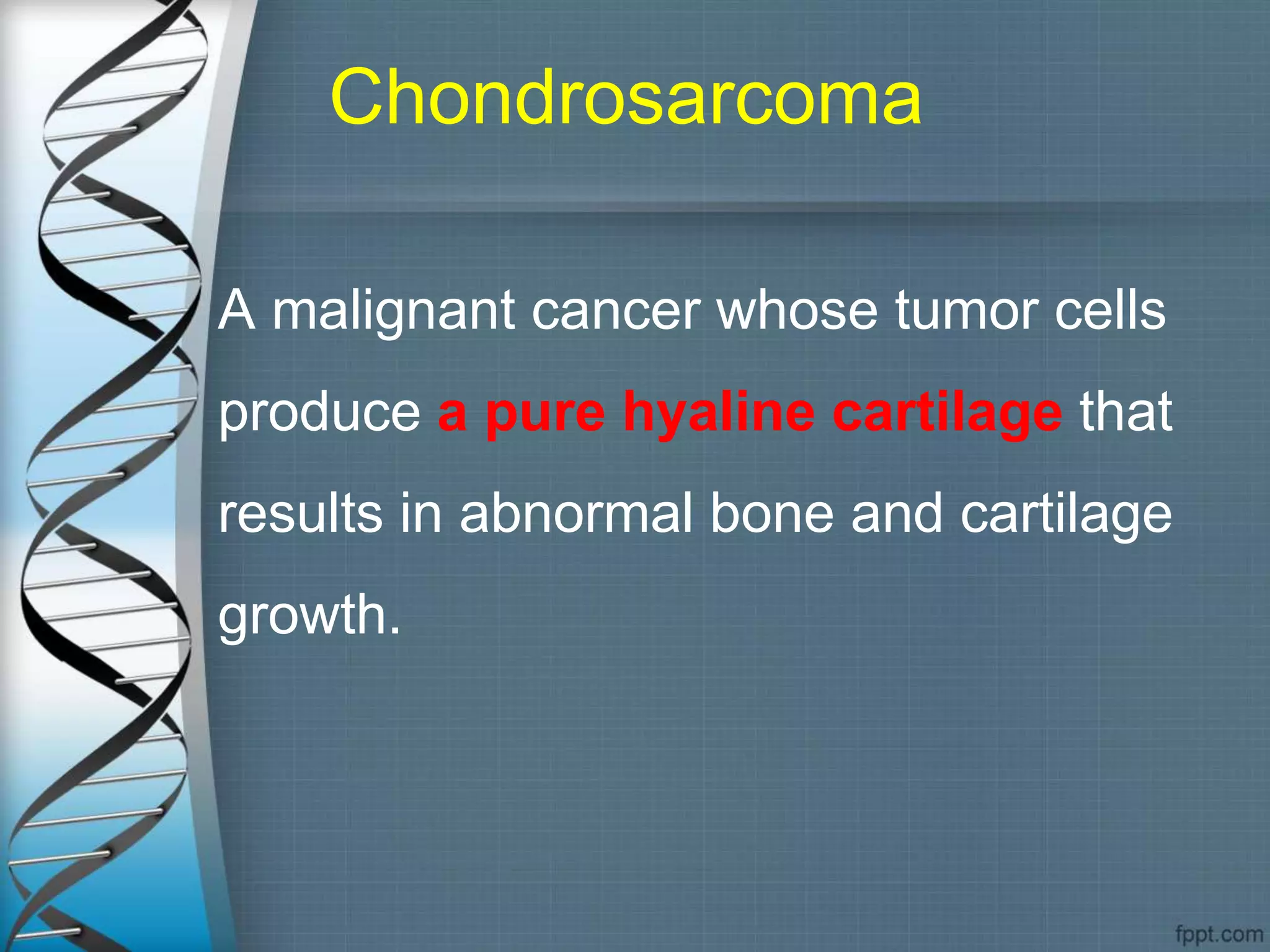chondrosarcoma | PPT