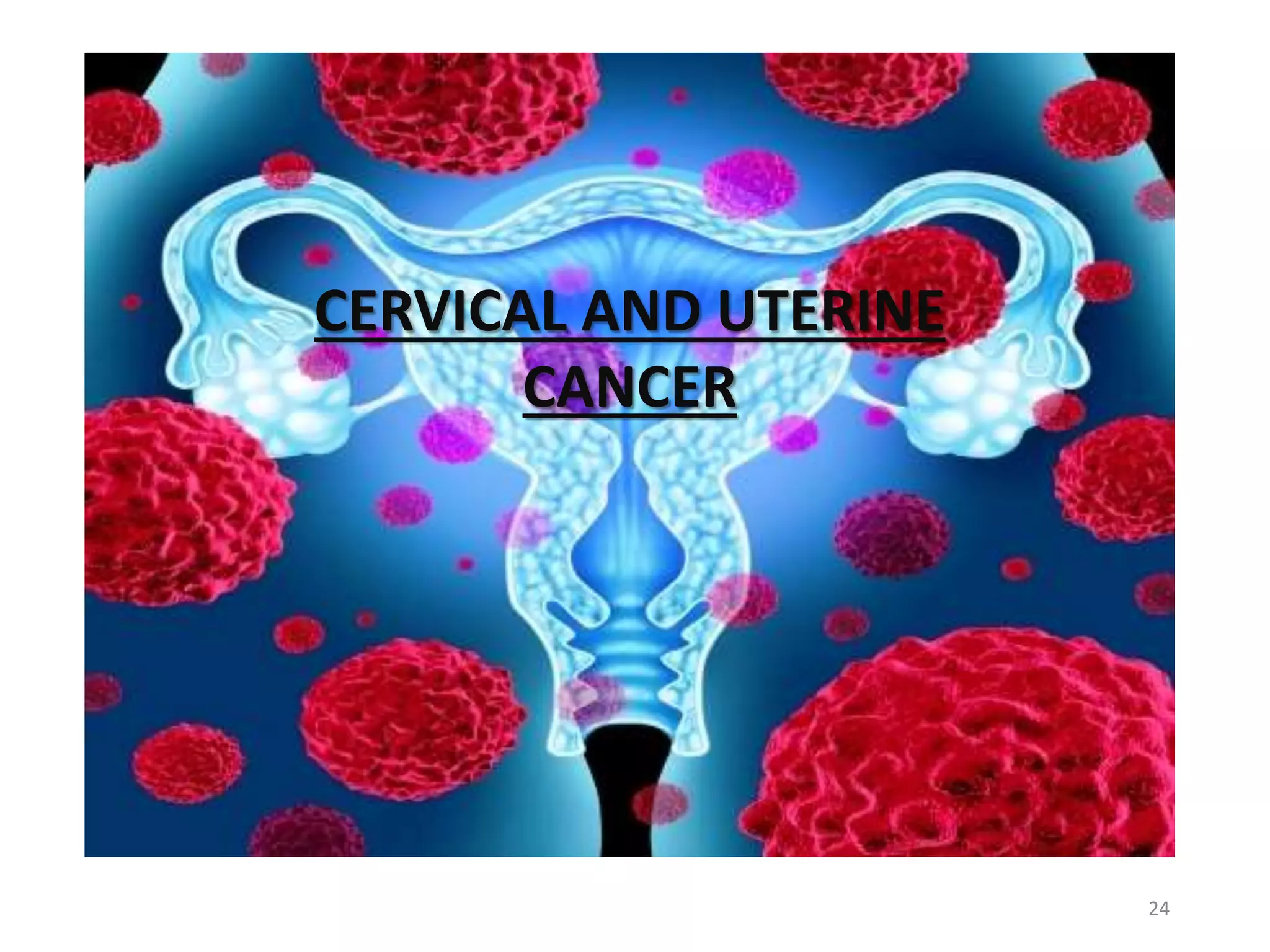 Common Cancers in Women | PPTX
