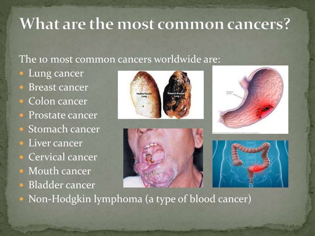 Cancer presentation | PPT