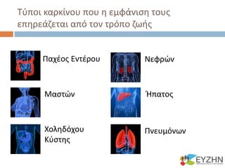 ΠΡΟΛΗΨΗ ΚΑΡΚΙΝΟΥ | PPSX