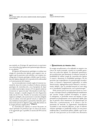 Cancer primario de peritoneo | PDF