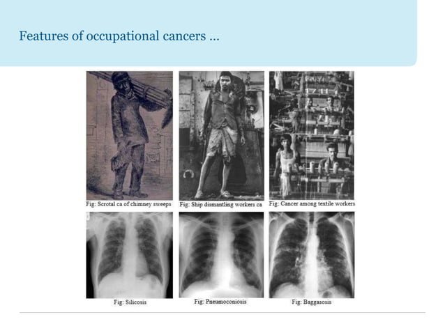 Cancers in occupational settings | PPT