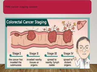 cancer staging.pptx