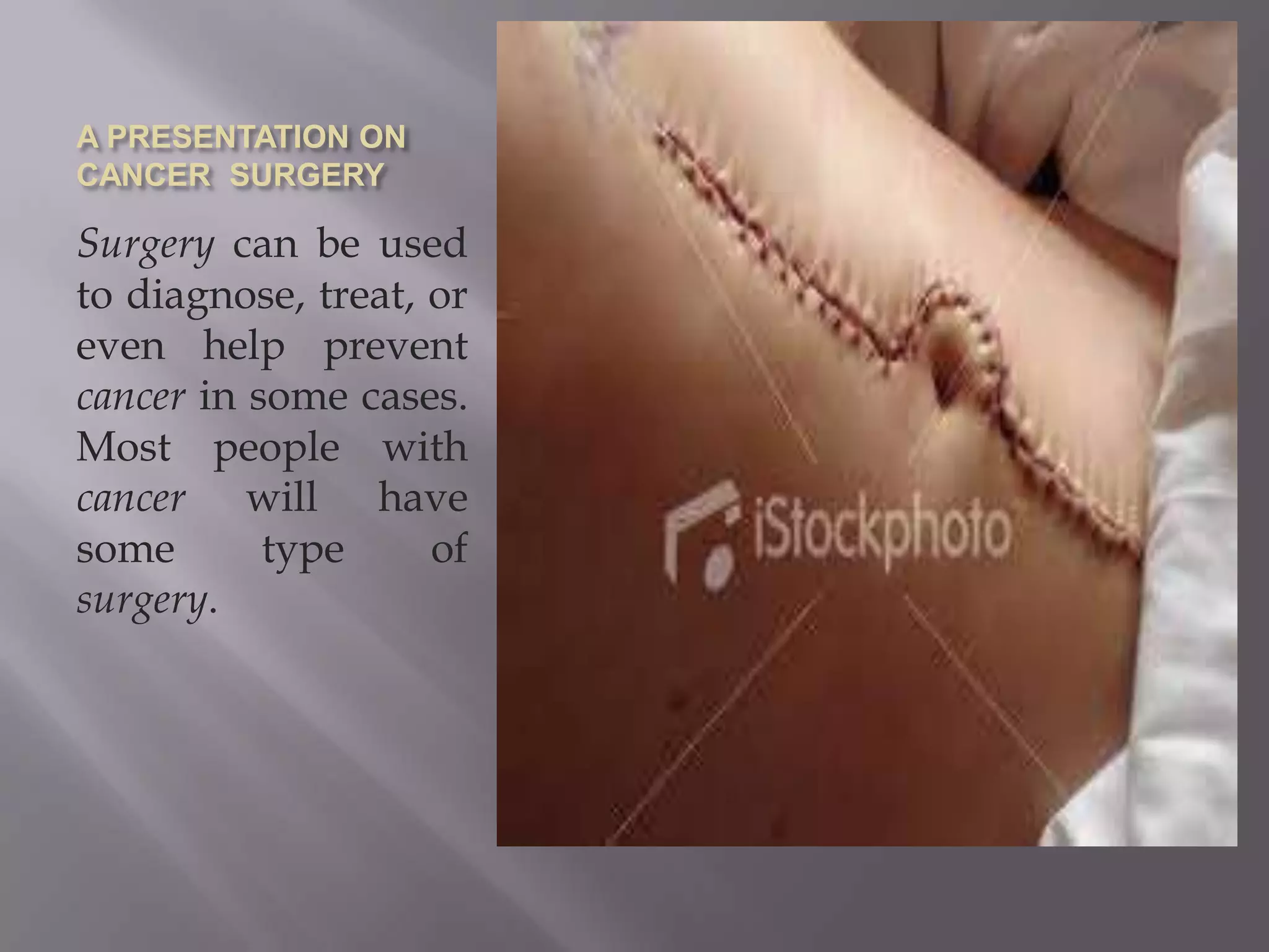 Cancer surgery | PPSX