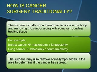 Cancer surgery | PPTX