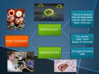 Cancer surgery | PPTX