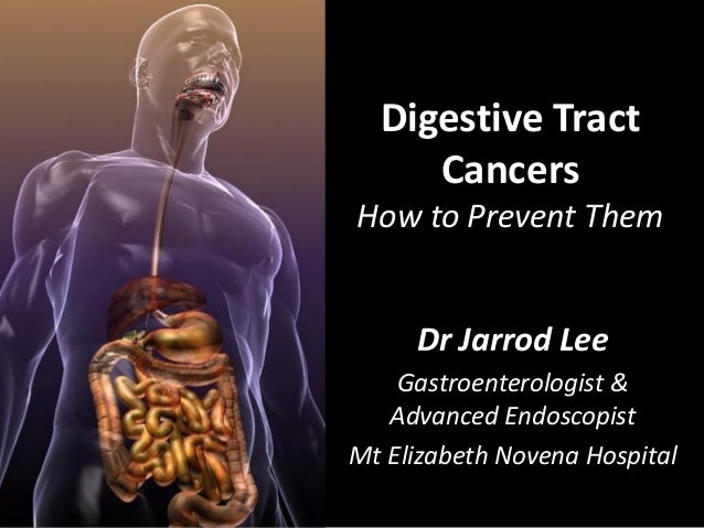 Digestive Tract Cancers & How to Prevent Them