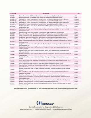 Biochain Cancer Tissue Array | PDF