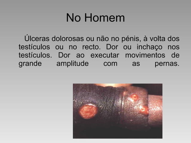 Cancro Mole