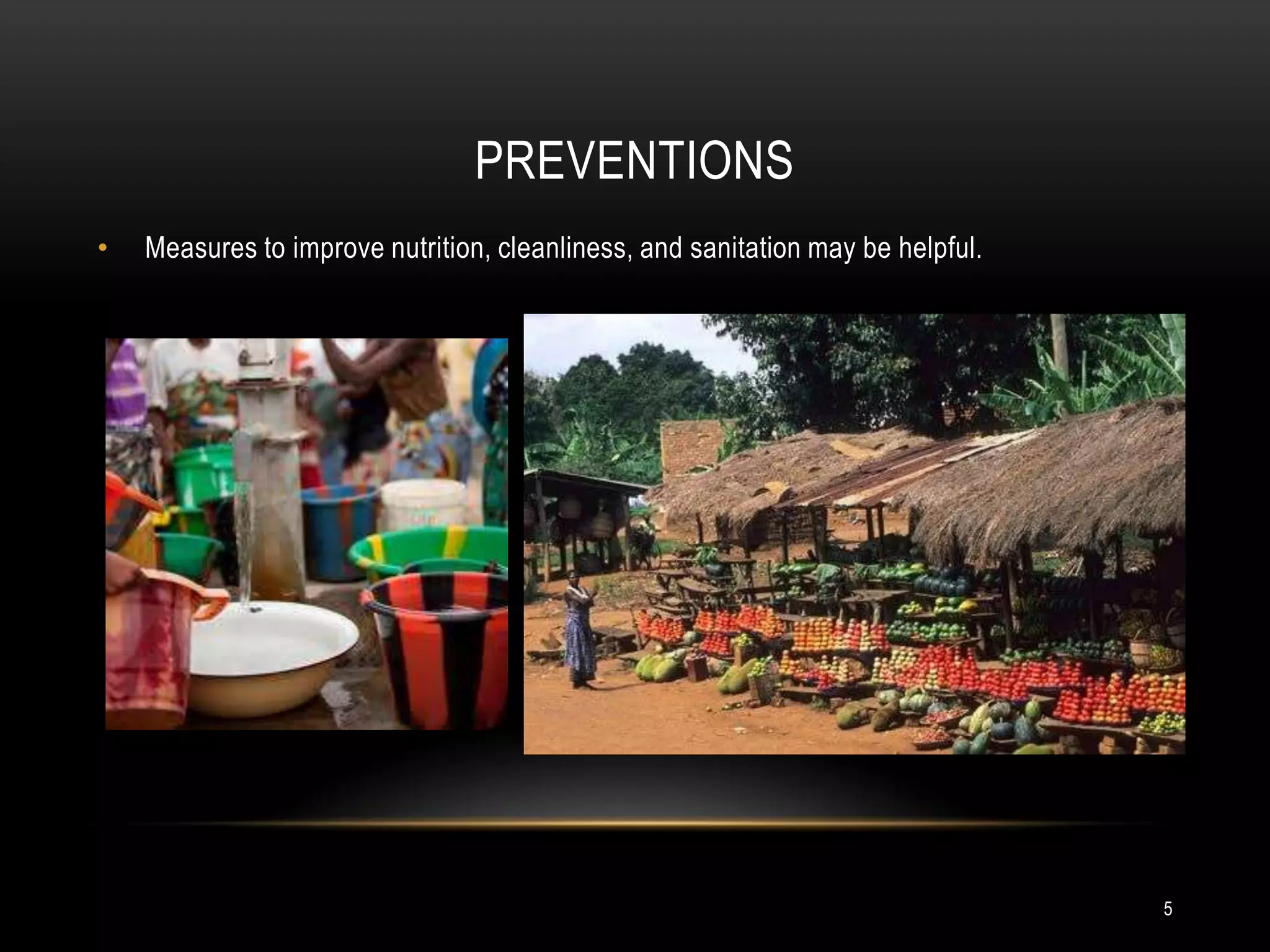 Cancrum oris or noma | PPTX