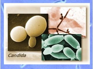 Candida | PPT